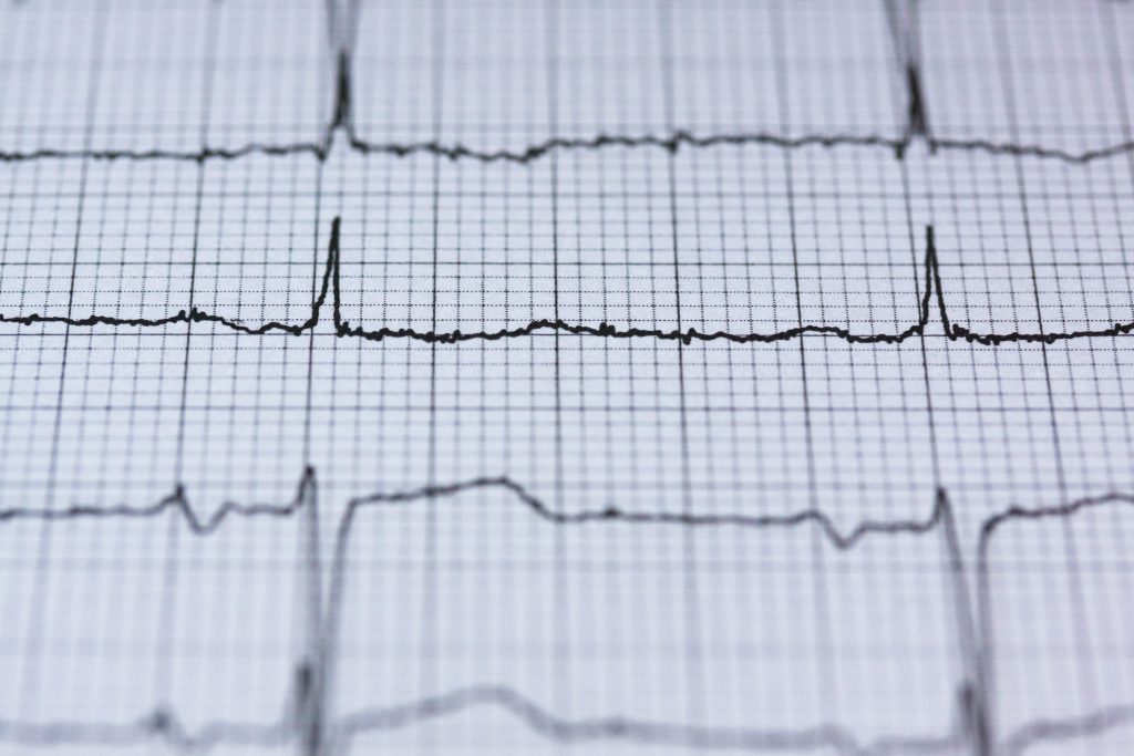 12-Lead ECG – HEART HEALTH SPECIALIST CENTRE